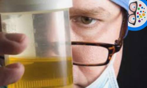 İdrar Rengi Anlamları – BiliminSesi | Sağlık ve Teknoloji